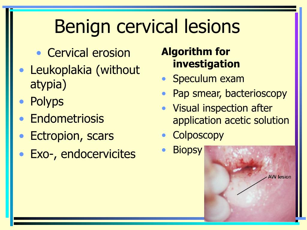 PPT - Benign diseases of the female sexual organs. PowerPoint ...