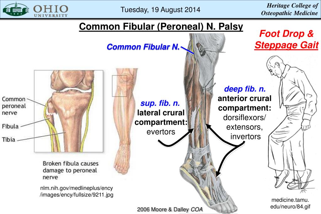 PPT - Understanding Ankle Injuries: Sprains, Fractures, and Anatomic ...