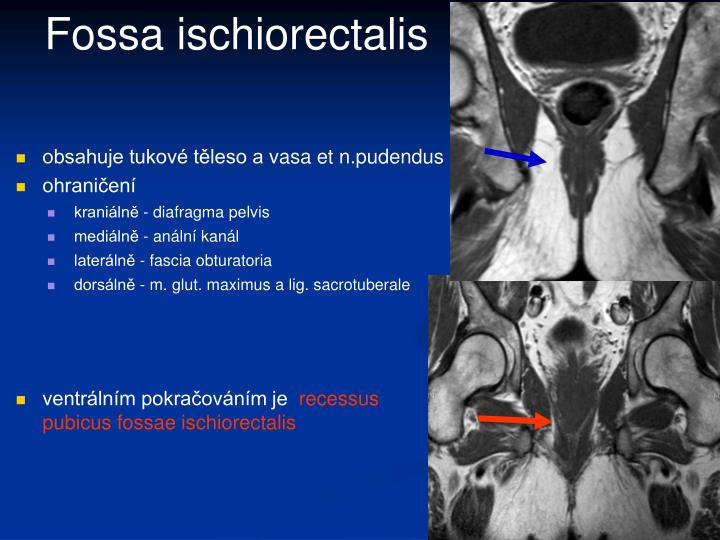 PPT - Anatomie pánve PowerPoint Presentation - ID:3330062
