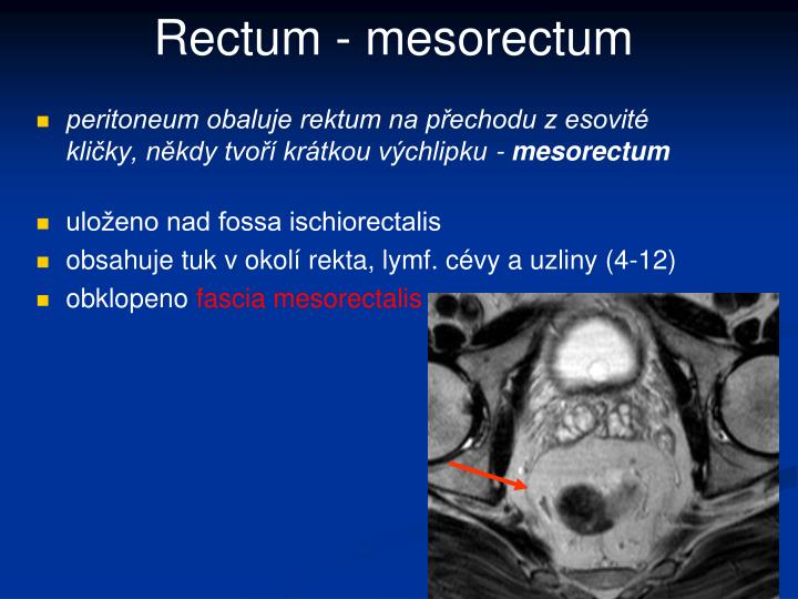 PPT - Anatomie pánve PowerPoint Presentation - ID:3330062