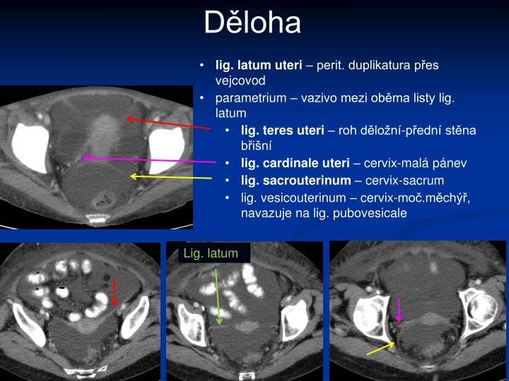 PPT - Anatomie pánve PowerPoint Presentation - ID:3330062