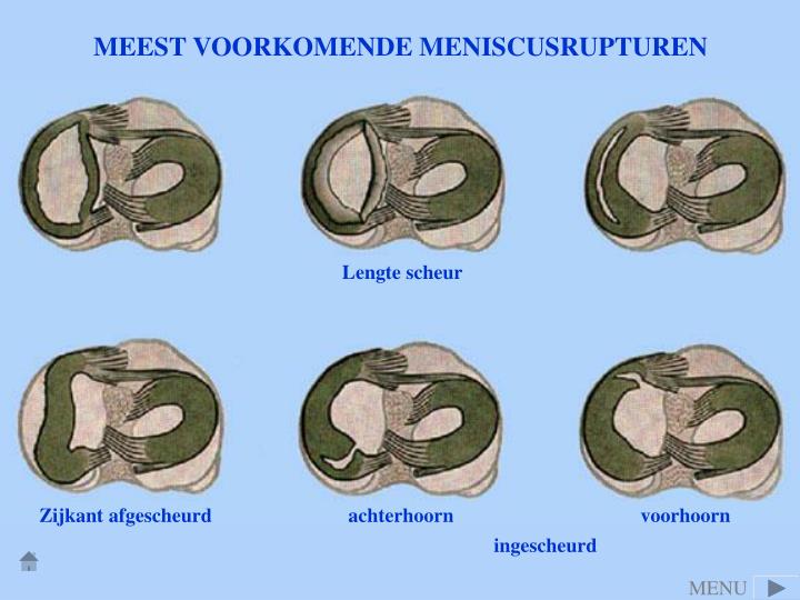 PPT - DE KNIE PowerPoint Presentation - ID:3330546