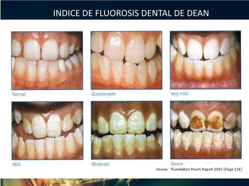 PPT - UNIVERSIDAD ROMULO GALLEGOS AREA DE ODONTOLOGIA CATEDRA DE ...