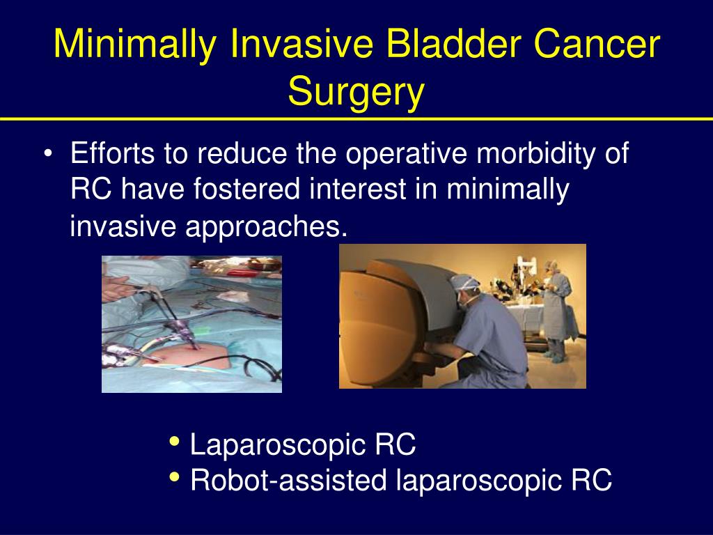 PPT - Douglas S. Scherr, M.D. Weill Medical College of Cornell ...