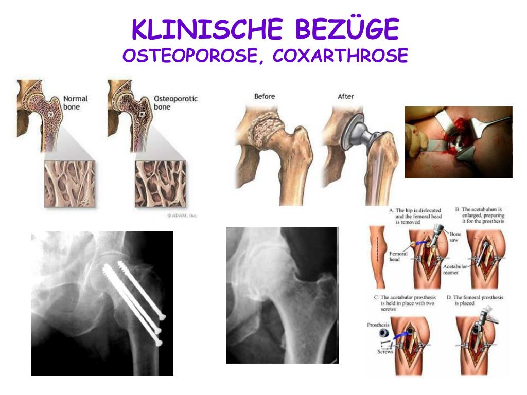 PPT - BECKEN (KNOCHEN UND BÄNDER) ARTICULATIO COXAE PowerPoint ...