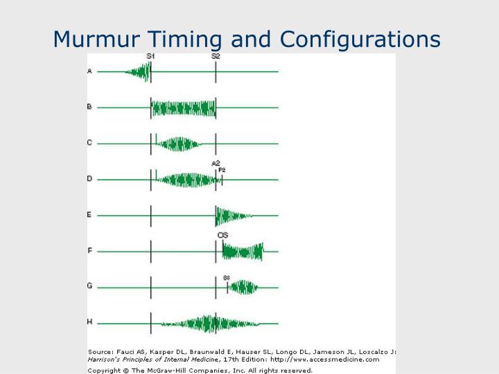 PPT - Heart Sounds and Murmurs PowerPoint Presentation - ID:3330936