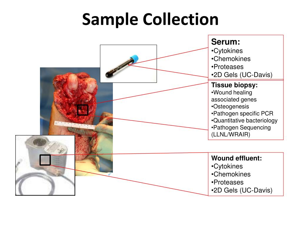 PPT - Technological Advancement in the Surgical Treatment of War Wounds ...