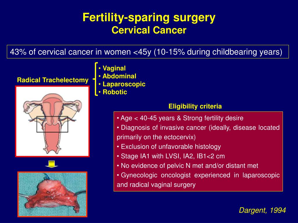 Ppt Carcinoma Della Cervice Uterina Cronoprogramma Diagnostico