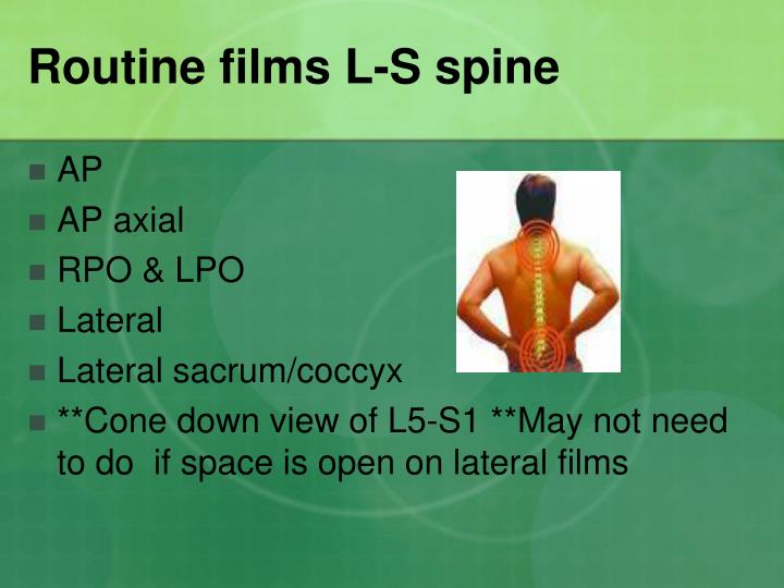 PPT - L spine and etc… No running with Keys! PowerPoint Presentation ...