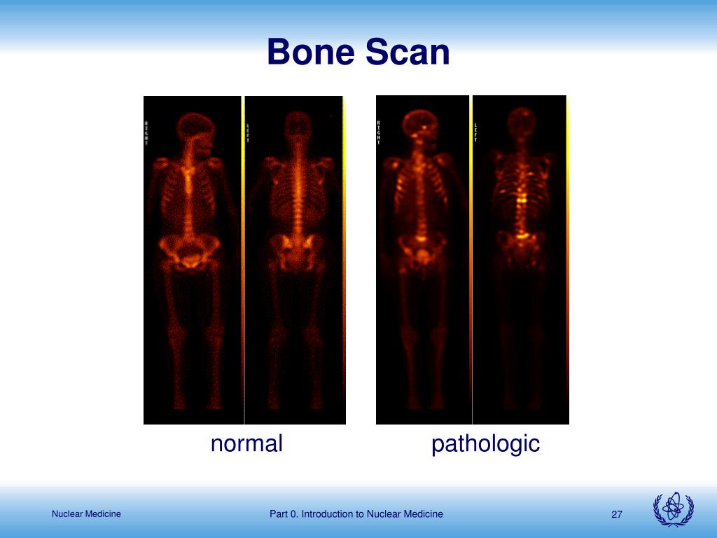 PPT - RADIATION PROTECTION IN NUCLEAR MEDICINE PowerPoint Presentation ...