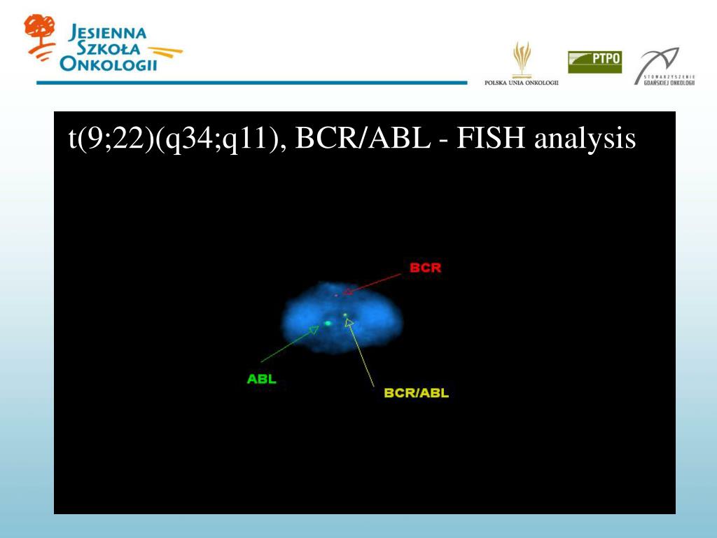 PPT - Diagnostyka cytogenetyczna i molekularna białaczek PowerPoint ...