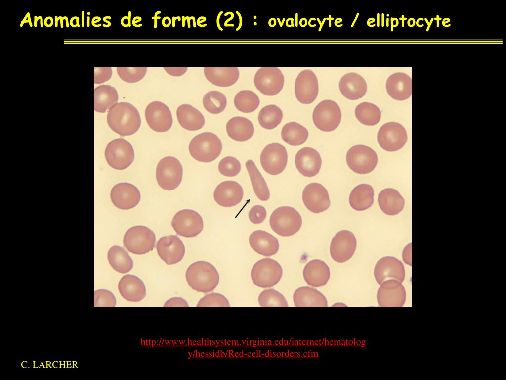 PPT - Etude morphologique des hématies PowerPoint Presentation, free ...
