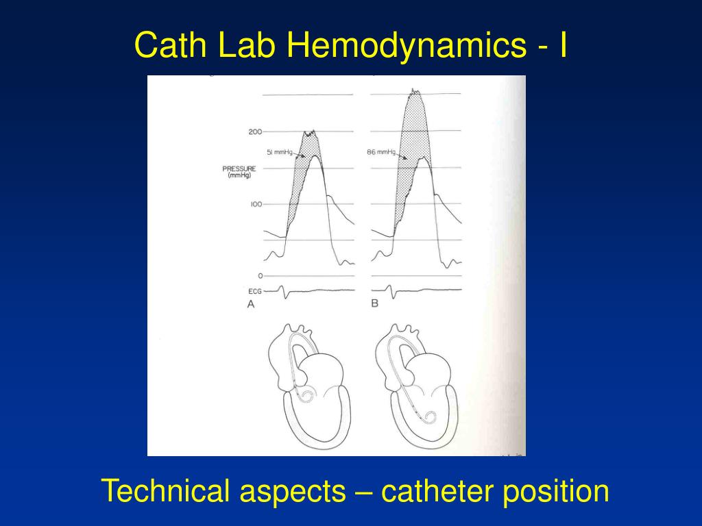 PPT - Cath-Lab Hemodynamics – I : Pressure tracings in the diseased ...