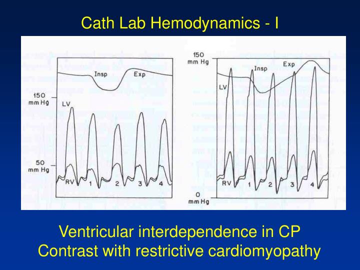 PPT - Cath-Lab Hemodynamics – I : Pressure tracings in the diseased ...
