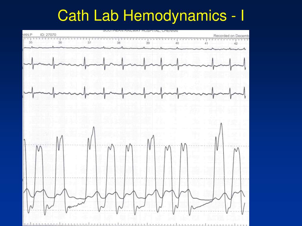 PPT - Cath-Lab Hemodynamics – I : Pressure tracings in the diseased ...