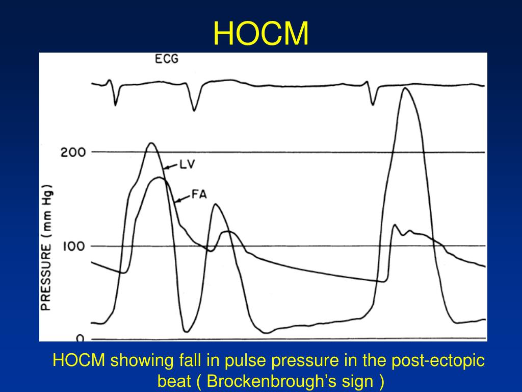 PPT - Cath-Lab Hemodynamics – I : Pressure tracings in the diseased ...