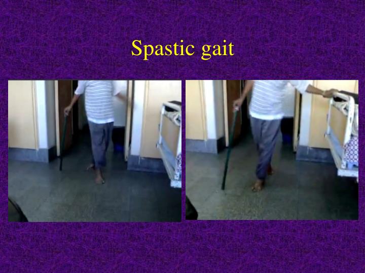 PPT - EXAMINATION OF THE FOOT AND ANKLE PowerPoint Presentation - ID ...