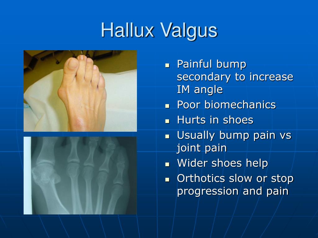 PPT - Diagnosis and Treatment of Common Foot Conditions PowerPoint ...