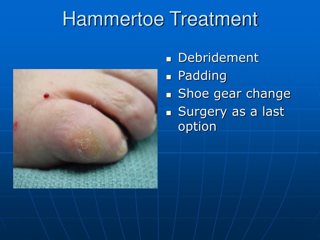 PPT - Diagnosis and Treatment of Common Foot Conditions PowerPoint ...