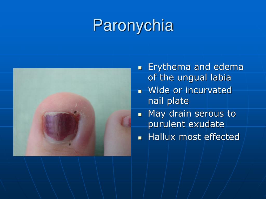 PPT - Diagnosis and Treatment of Common Foot Conditions PowerPoint ...