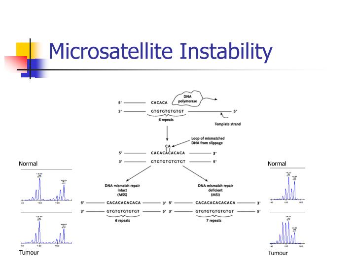 PPT - Microsatellite Instability in Sporadic Colorectal Cancer: A ...