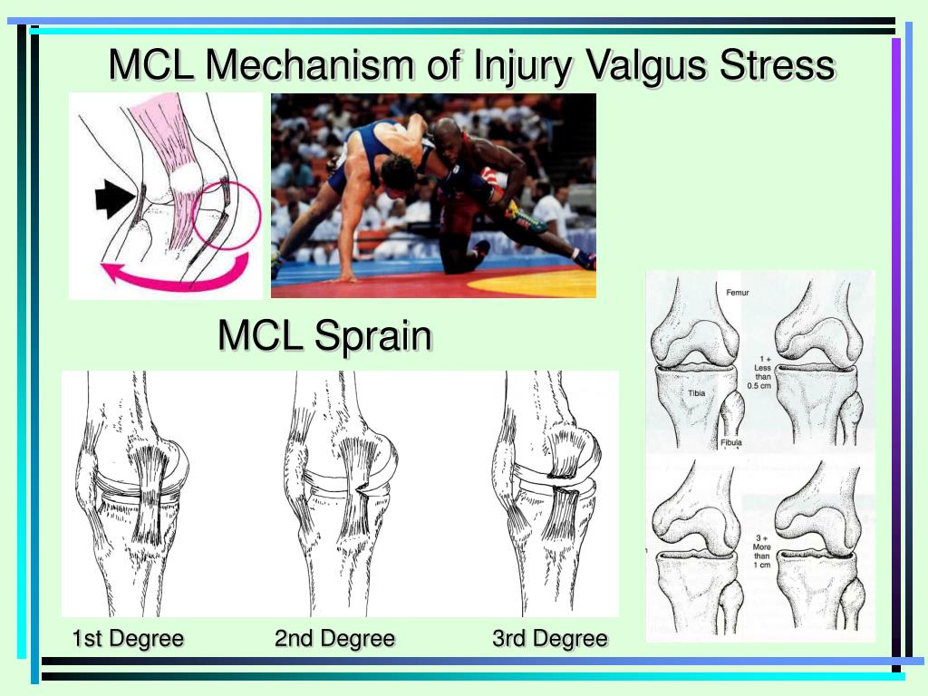PPT - Femur Patellar surface femur Lateral condyle & epicondyle Head ...
