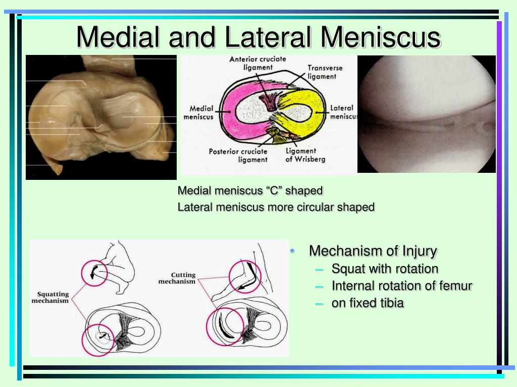 PPT - Femur Patellar surface femur Lateral condyle & epicondyle Head ...
