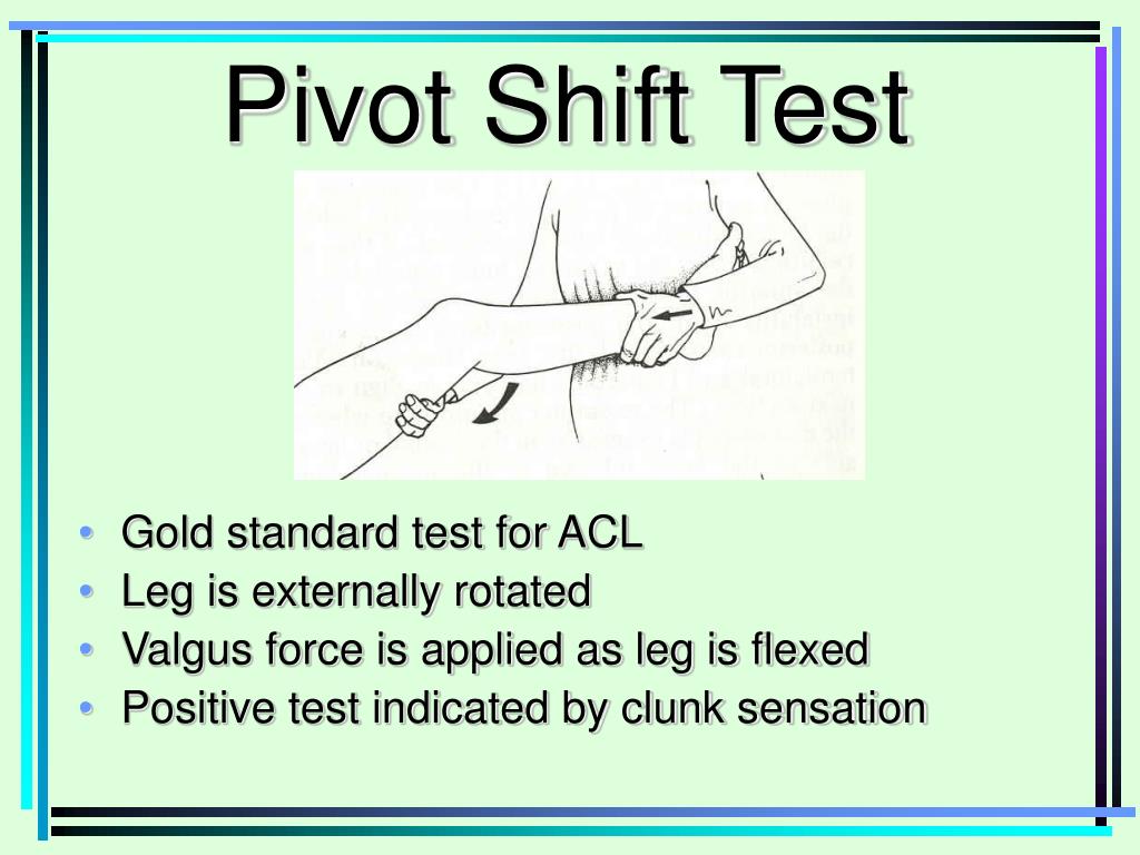 PPT - Femur Patellar surface femur Lateral condyle & epicondyle Head ...