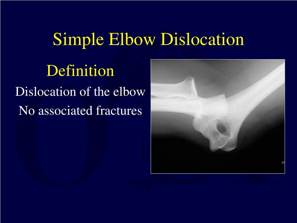 PPT - David Ring, MD PhD Massachusetts General Hospital Boston ...