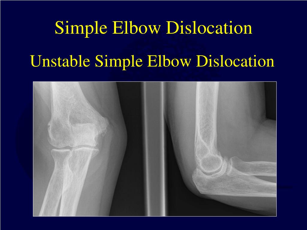 PPT - David Ring, MD PhD Massachusetts General Hospital Boston ...