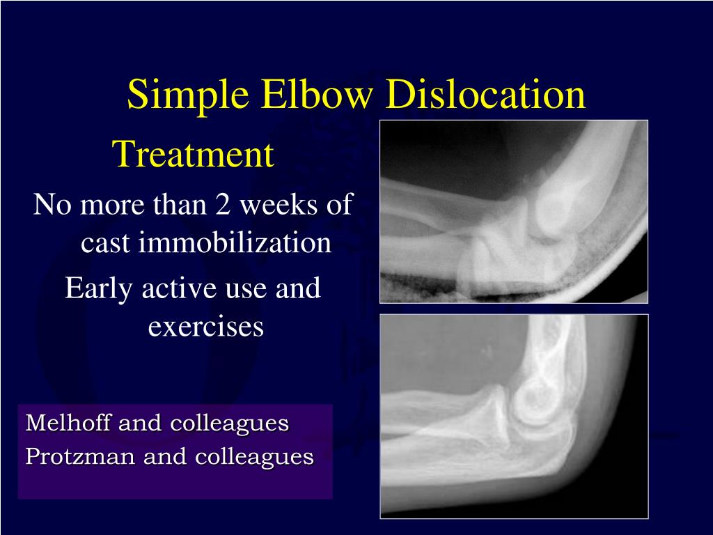 PPT - David Ring, MD PhD Massachusetts General Hospital Boston ...