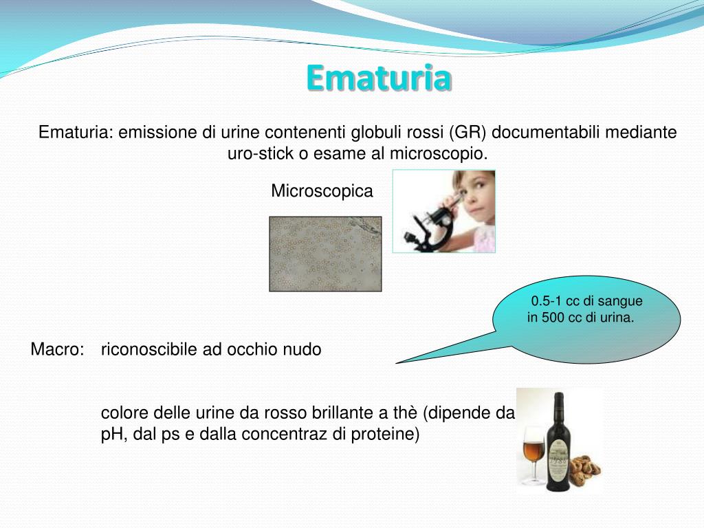 PPT - Esame urine, ematuria e proteinuria PowerPoint Presentation, free ...