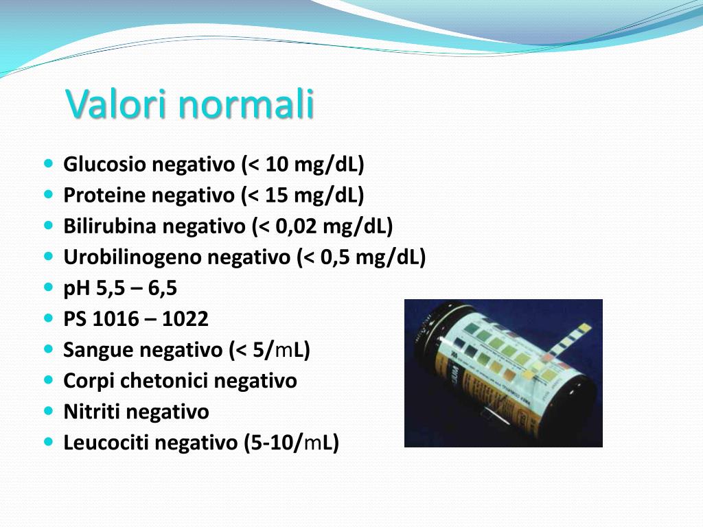 PPT - Esame urine, ematuria e proteinuria PowerPoint Presentation, free ...