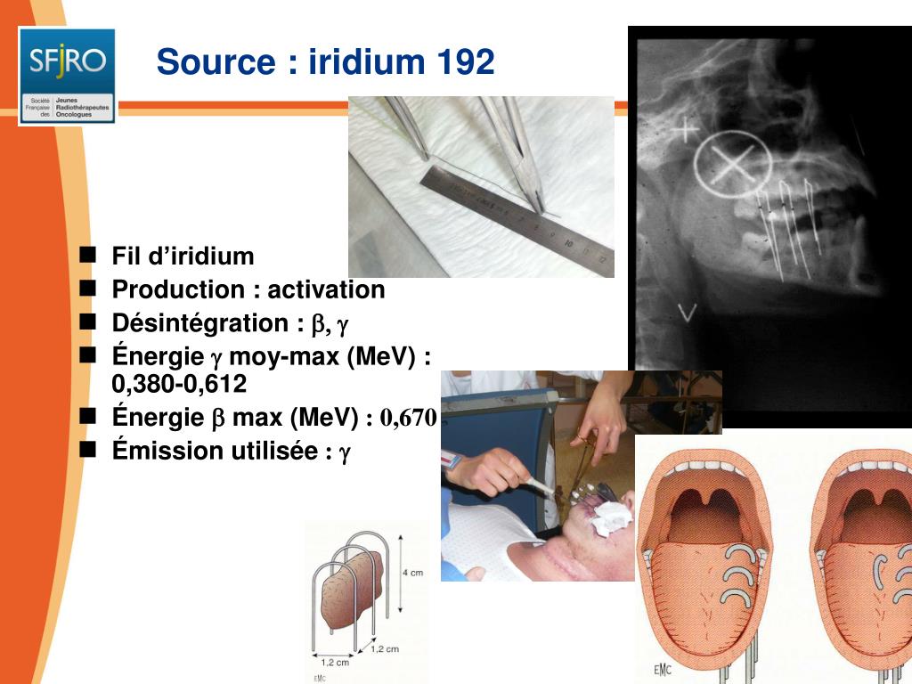 PPT - Cours nationaux de DES de Radiothérapie oncologique Nancy – 2 au ...