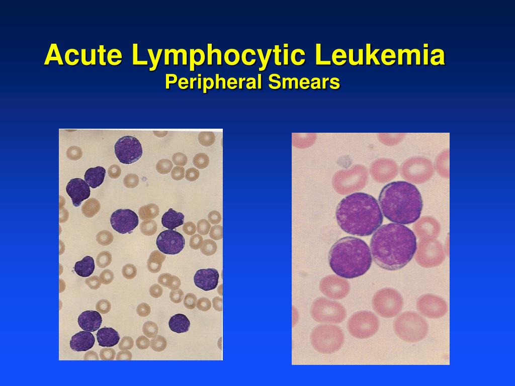 PPT - Joseph M. Wiley, MD Division of Pediatric Hematology-Oncology ...