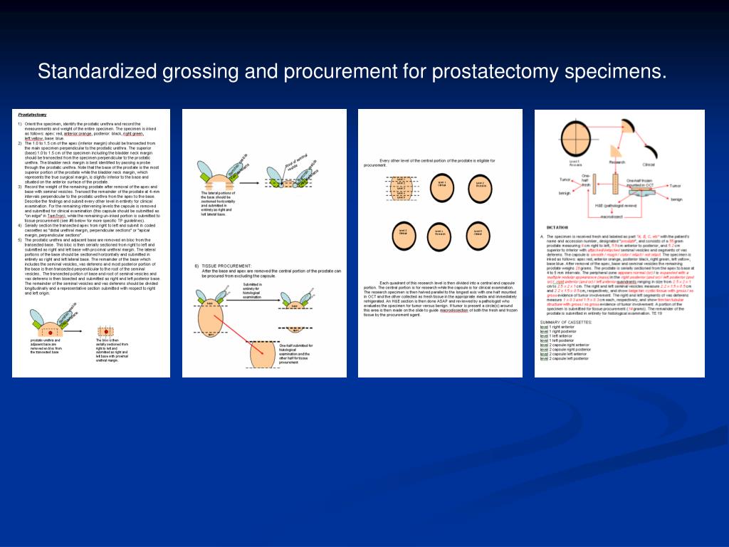 PPT - TISSUE PROCUREMENT AT CANCER CENTERS PowerPoint Presentation ...