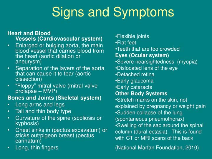 PPT - Marfan Syndrome PowerPoint Presentation - ID:3341414