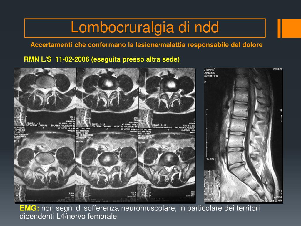 PPT - Incontro Nazionale Neurofisiologia: Nuove Strategie PowerPoint ...