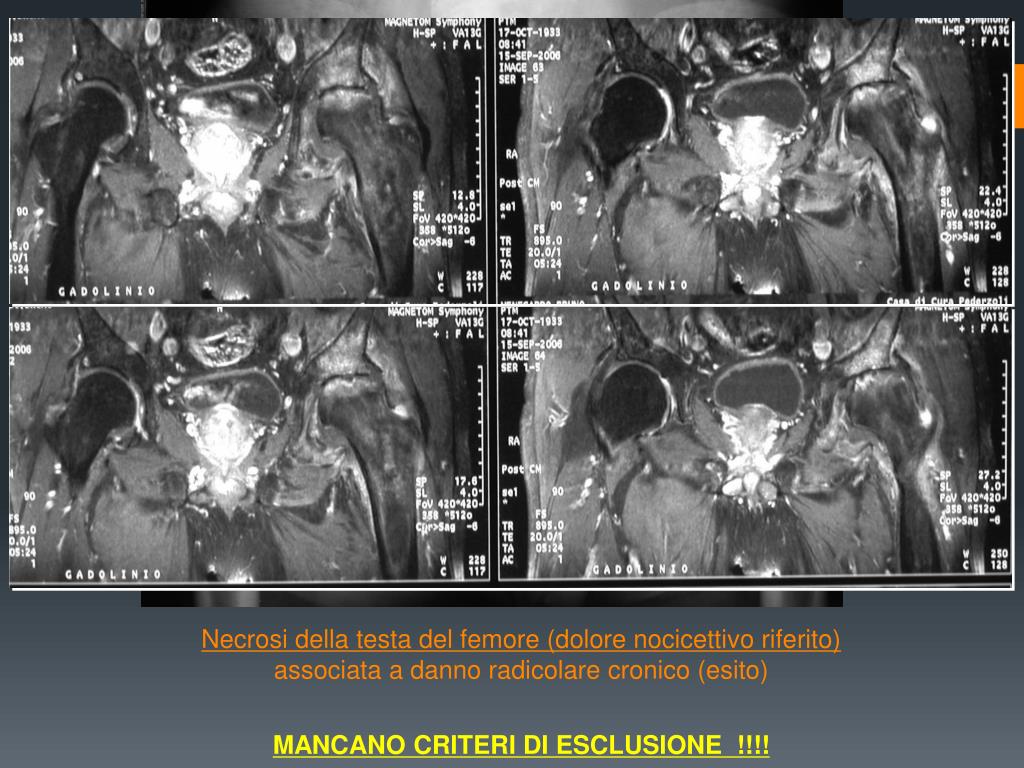 PPT - Incontro Nazionale Neurofisiologia: Nuove Strategie PowerPoint ...