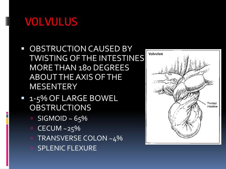 PPT - VOLVULUS PowerPoint Presentation - ID:3343529