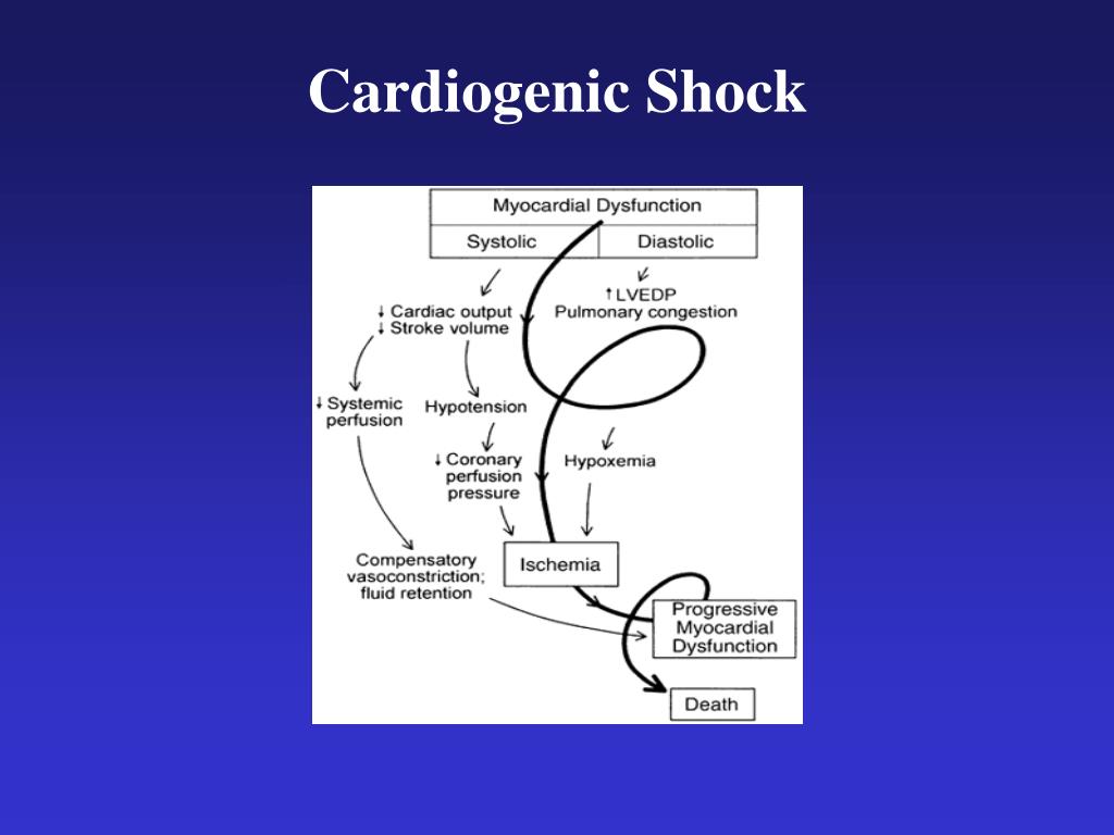 PPT - Cardiogenic Shock Diagnosis, Treatment and Guidelines PowerPoint ...