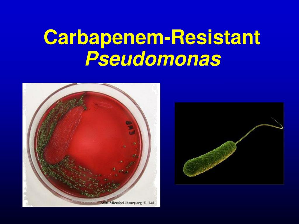PPT - Emerging Carbapenem Resistance: What Do We Do Now? PowerPoint ...