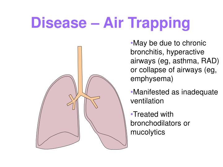 PPT - Lung: Anatomy & Physiology PowerPoint Presentation - ID:3344713