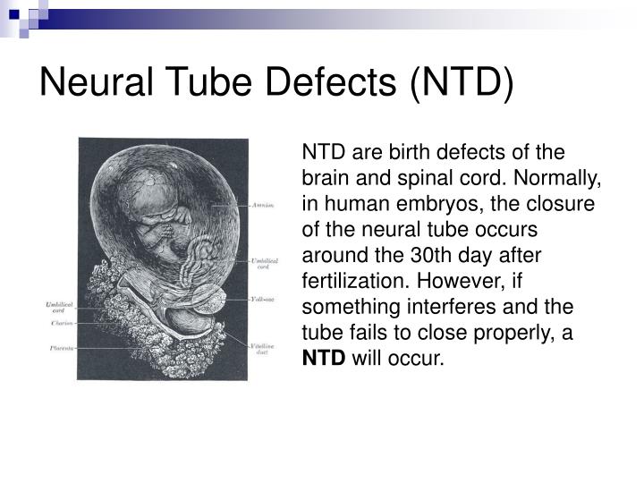 PPT - Folic Acid and Neural Tube Defects PowerPoint Presentation - ID ...