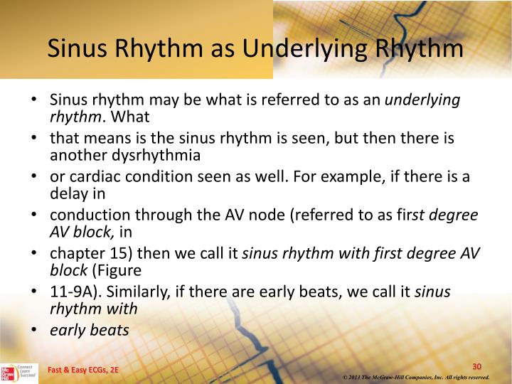 PPT - Sinus Dysrhythmias PowerPoint Presentation - ID:3345190