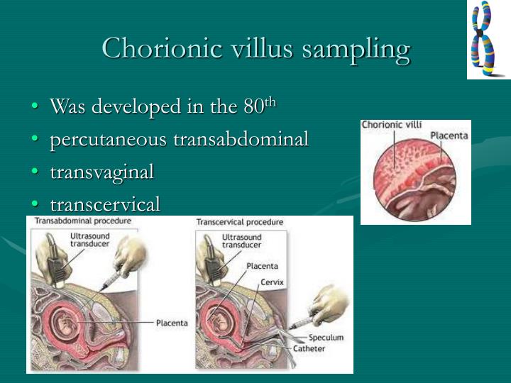 PPT - ASSESSMENT OF Fetal Well-being PowerPoint Presentation - ID:3345248