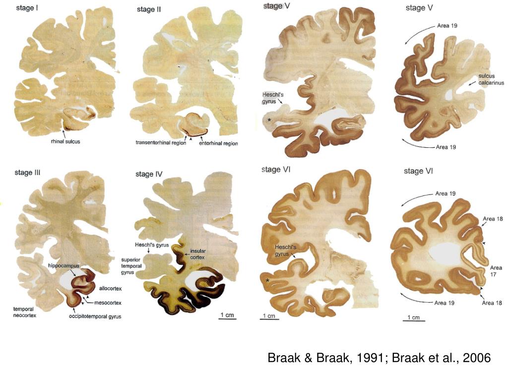 PPT - NUCLEAR MEDICINE GRAND ROUNDS Stanford University J. Wesson ...