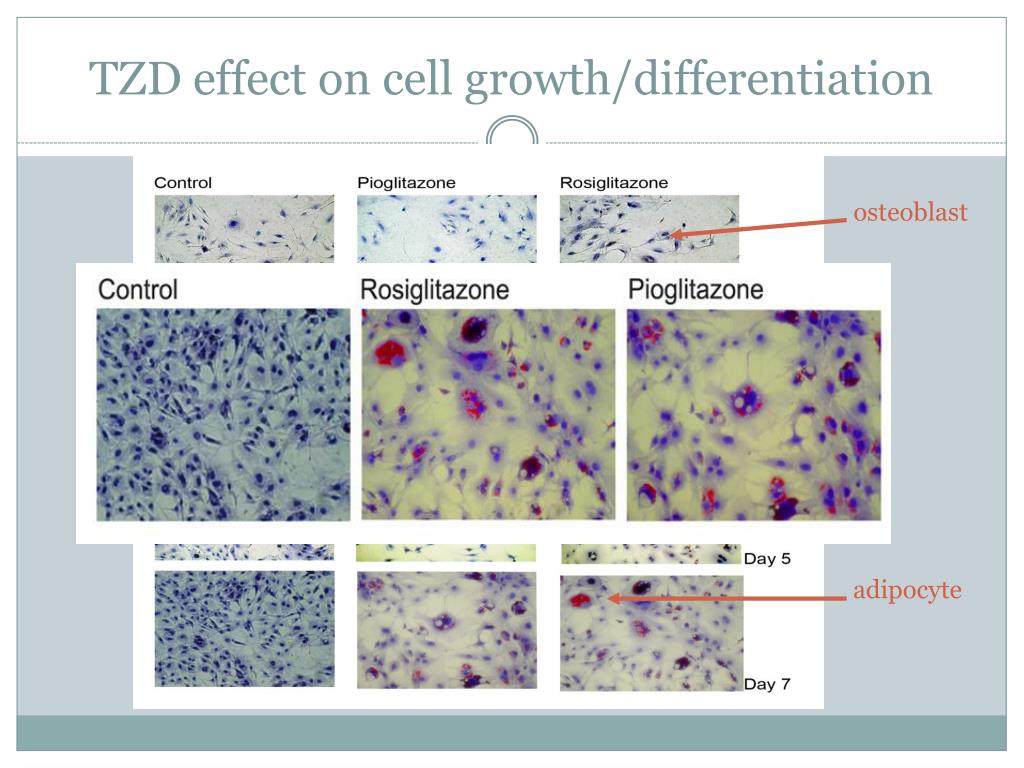 PPT - Thiazolidinediones and Bone Metabolism: in-vitro studies ...