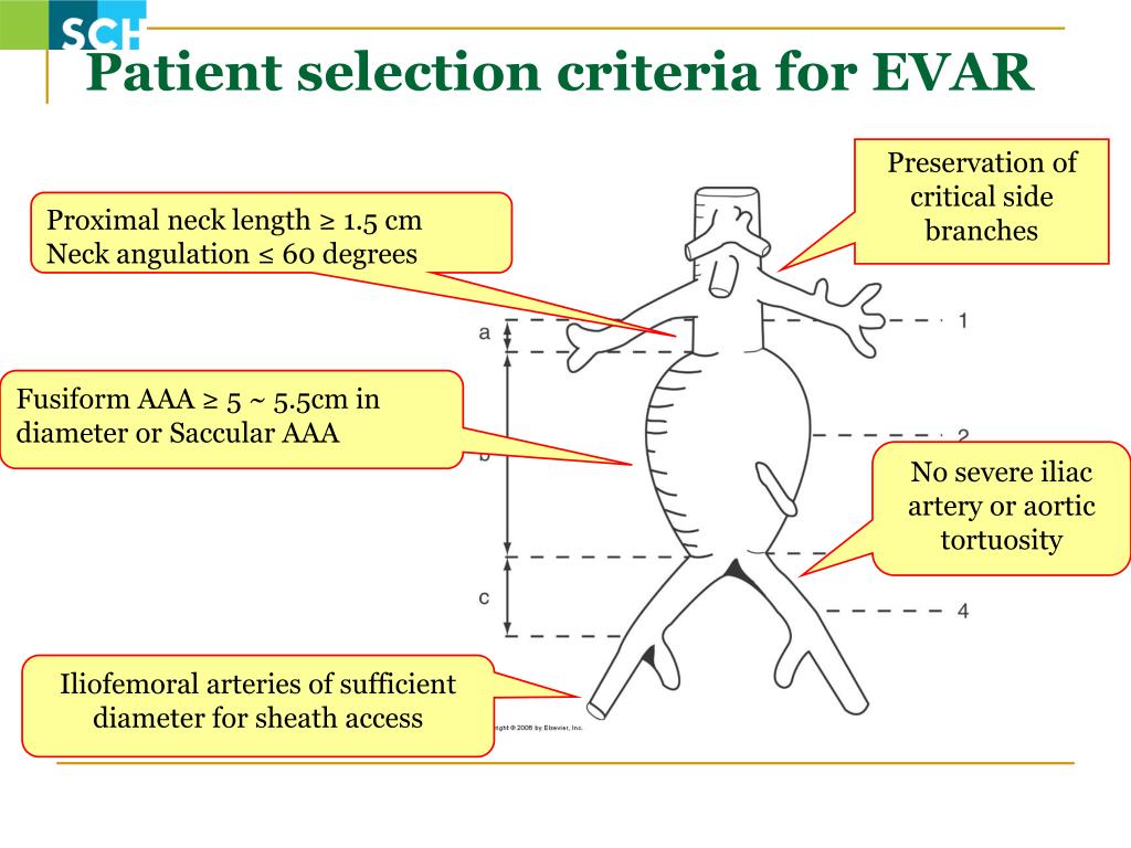 PPT - Abdominal Aortic Aneurysm and Peripheral Disease PowerPoint ...