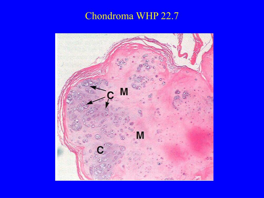 PPT - Diseases of the Musculoskeletal System PowerPoint Presentation ...